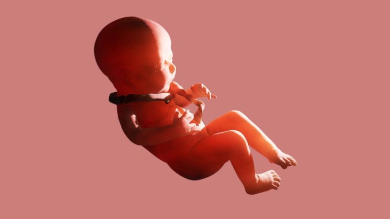 How-to-remove-cord-around-baby's-neck | Sitaram Bhartia Institute of ...