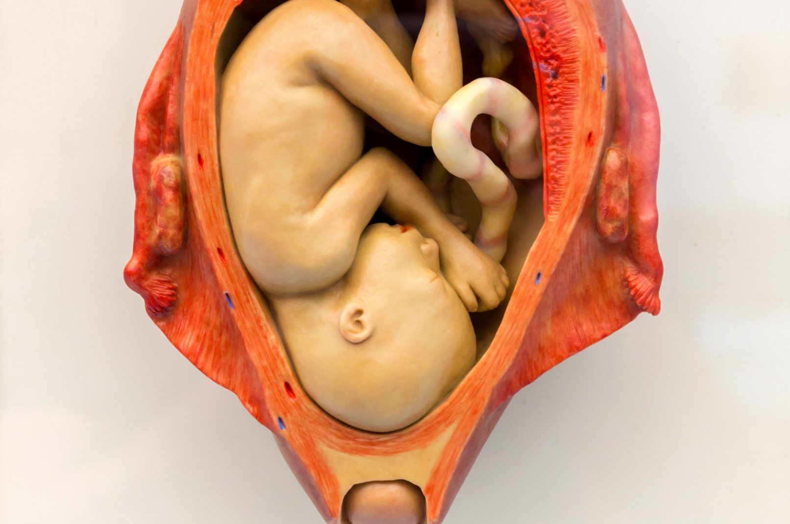 Vertex Presentation What It Means For You Your Baby Sitaram 