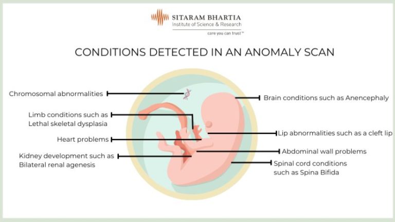 How an Anomaly Scan Helps & Why You Need It - Sitaram Bhartia Blog